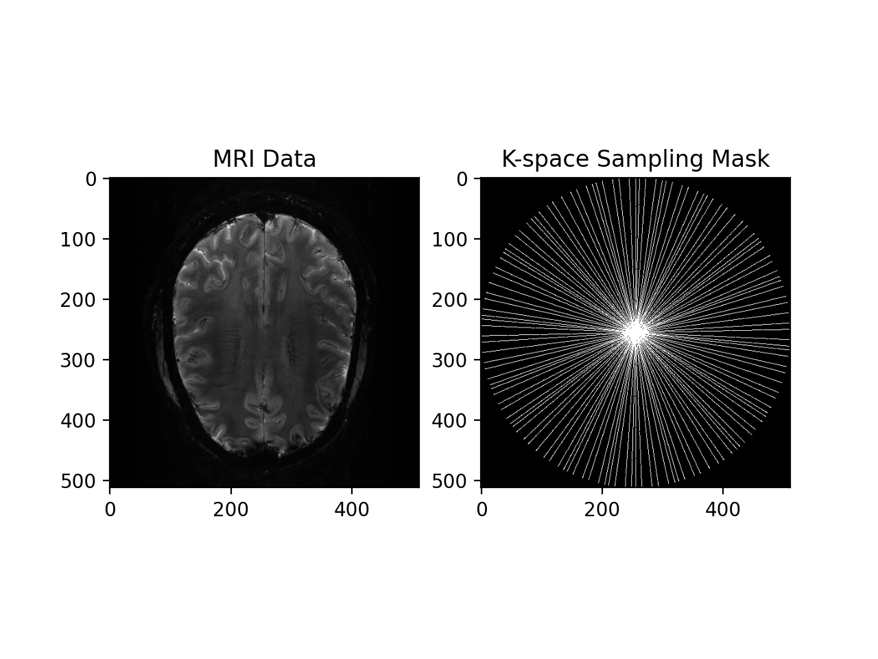 GPU Density Compensation Reconstruction Comparison — pysap v0.2.1