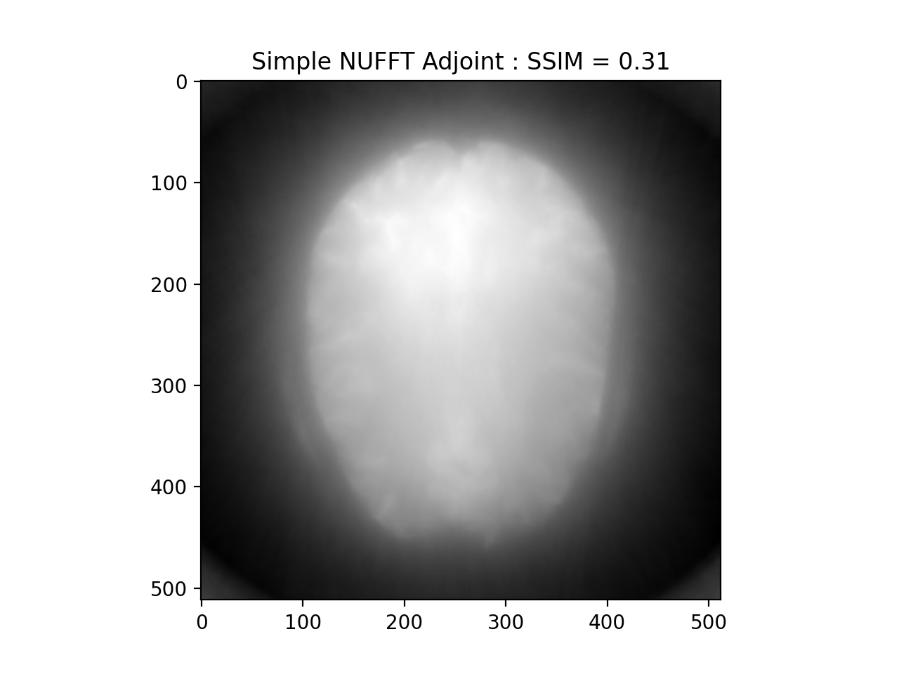 Gpu Density Compensation Reconstruction Comparison — Pysap V0 2 1