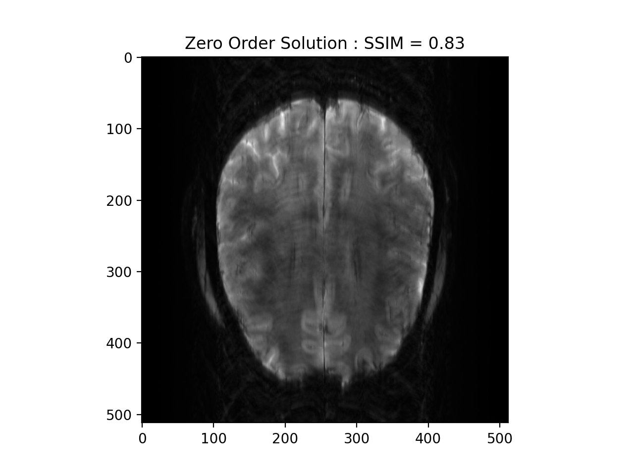 Cartesian Self Calibrating Reconstruction — pysap v0.2.1 Cartesian Self Calibrating Reconstruction — pysap v0.2.1