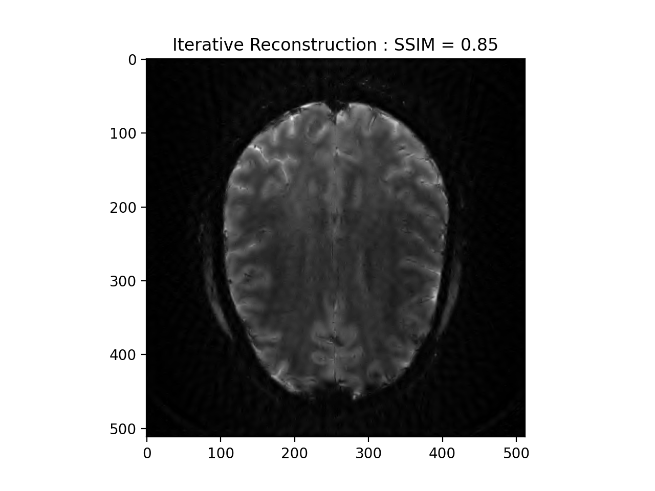 GPU Non-cartesian 2D reconstruction: Undecimated Wavelet — pysap v0.2.1